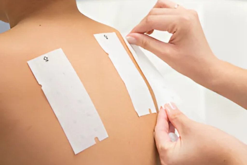 Allergy Patch Testing - Daher Asthma & Allergy Clinic